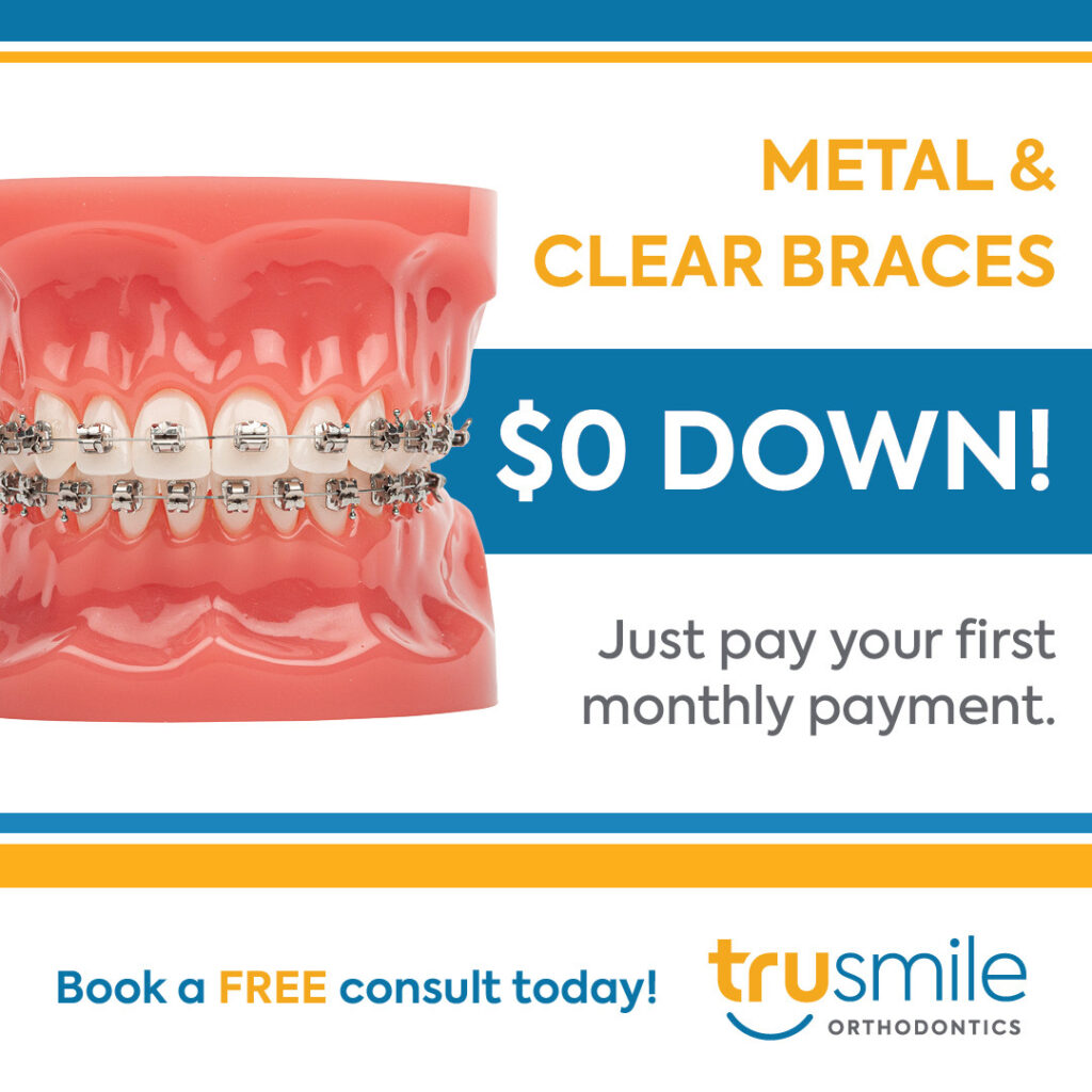 Orthodontic Promotions - TruSmile Orthodontics, Culver City & Long Beach CA
